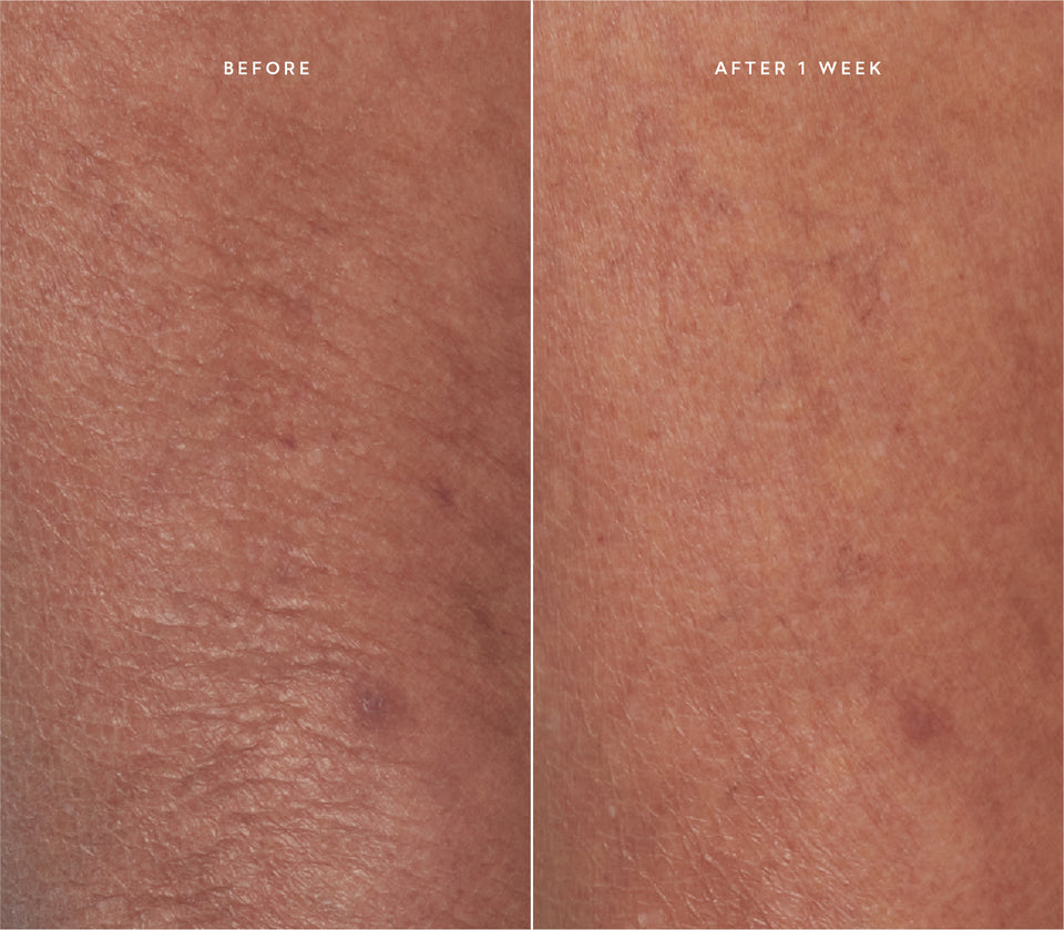 Get Glowing Skin with Natural Body Oil - True Botanicals