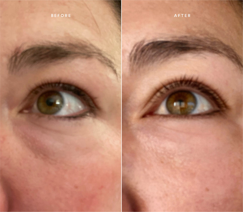 Resurrection Radiance Eye Cream | True Botanicals