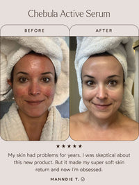 Chebula Active Serum for Hydrated Skin | True Botanicals