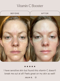 Topical Vitamin C Booster Powder | True Botanicals