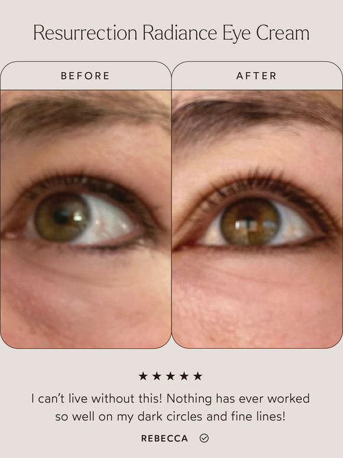 Brightening Eye Cream: Resurrection Radiance | True Botanicals